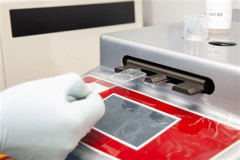 Scientist Preparing Microscope Slides With Liquid Based Cytology Method For Pap Smear Test
