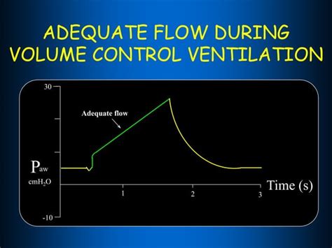 Ventilator Waveforms Dr Sanjay Chugh Pptx