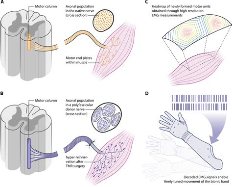 Peripheral Neural Interfaces Skeletal Muscles Are Hyper Reinnervated