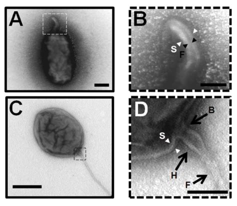 What Is The Difference Between Brucella Abortus And Melitensis