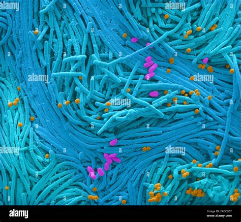 Nasal Bacterial Culture Coloured Scanning Electron Micrograph Sem Of