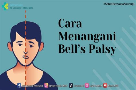 Bells Palsy Myths Vs Facts Archyde
