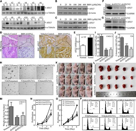 Atg7 Overexpression Is Crucial For Tumorigenic Growth Of Bladder Cancer