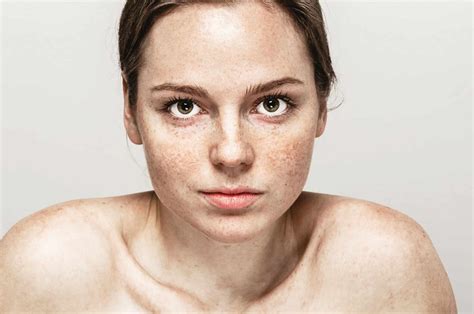 Sarcoïdose Symptômes Traitements Et Complications Information Hospitalière Lexique Et