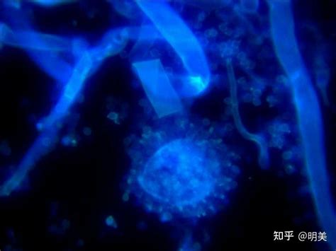 不同种类的真菌用什么显微观察？ 知乎