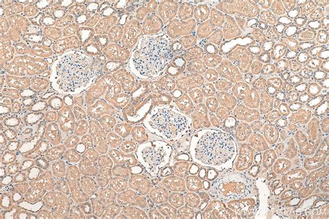 Dnmt3a Antibody 19366 1 Ap Proteintech