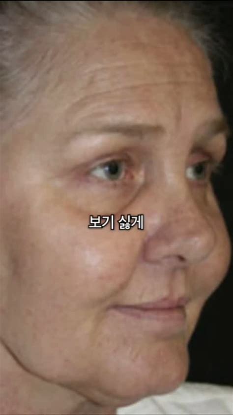 더왈츠클리닉 The Walts 이중턱 방치하면 큰일나는 이유 이중턱 이중턱없애기 이중턱리프팅 이중턱관리 더왈츠