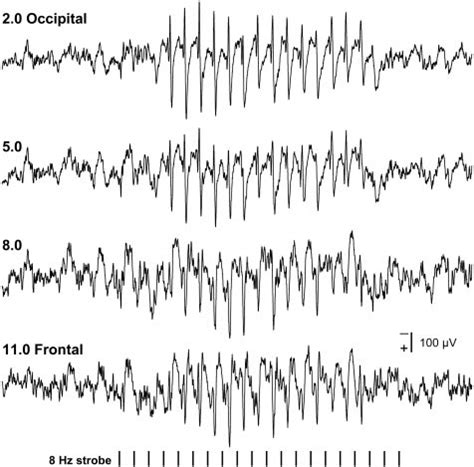 Spike Wave Response Generalizes Simultaneous Individual Recordings Download Scientific Diagram