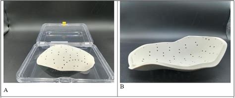 Romania Comparing Additively And Conventionally Manufactured Patient Specific Cranial Implants