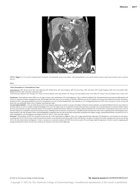 Pdf S3532 A Rare Presentation Of A Duodenal Neuroendocrine Tumor