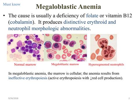 4 Macrocytic Anemiappt