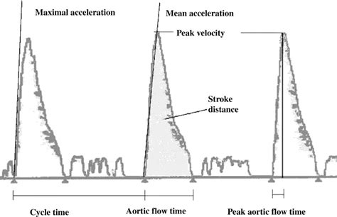 Typical Flow Velocity Waveform Obtained By Oesophageal Doppler Monitor Download Scientific