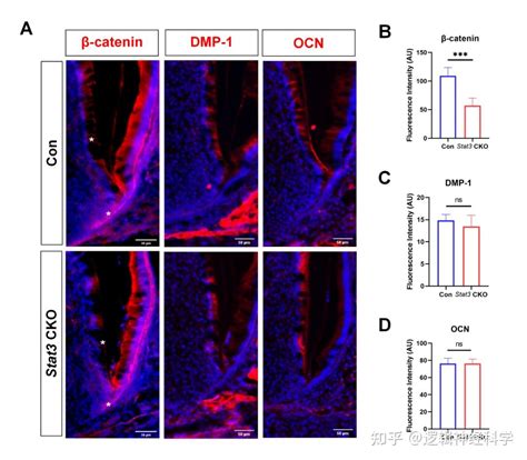 中山大学张晓磊团队通过培育转基因小鼠探索stat3基因在间充质细胞分化发育为牙体硬组织过程中的作用及其可能的内在机制 知乎