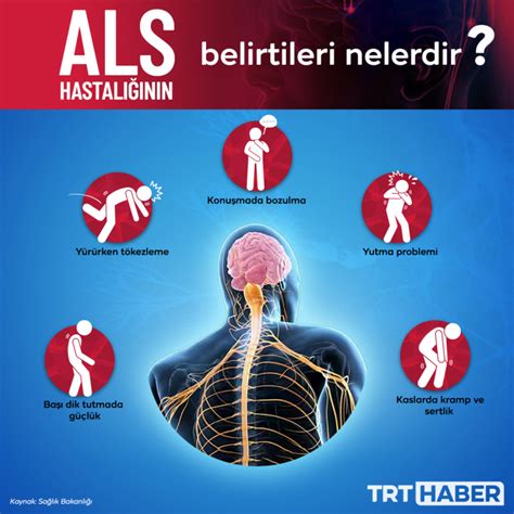 Alsde Erken Teşhis Fazlasıyla önemli Son Dakika Haberleri