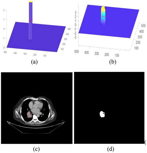A Initial Level Set Contour Regarding ‘t1 B Final Level Contour