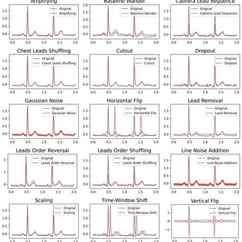 Data Augmentation Schemes Including Lead Ii Download Scientific Diagram