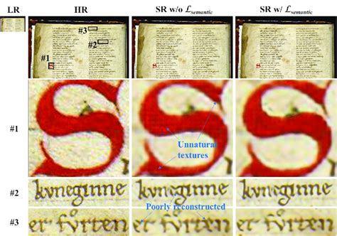 Visual Comparison Case 1 Of Text Sr Images With And Without The Download Scientific Diagram