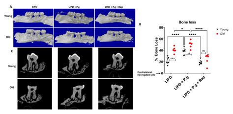 Alveolar Bone Loss As Function Of Age And Pg Gavage A Micro Ct