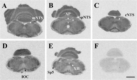 Representative Autoradiograms Of [k 33 P]datp Binding In Rat Brainstem Download Scientific