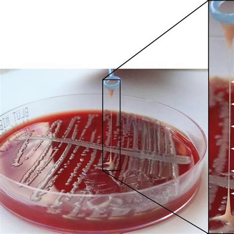 String Test Of E Coli Isolate 53720 A Strain Was Streaked Out On