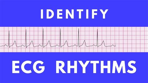 Identifying ECG Rhythms ACLS Precourse YouTube