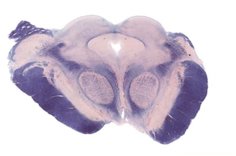 Midbrain Cross Section 1 Diagram Quizlet