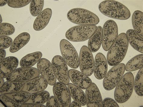 Ciliate Light Micrograph Stock Image C0584374 Science Photo Library