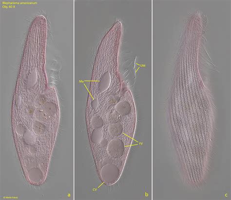 Blepharisma Americanum Real Micro Life