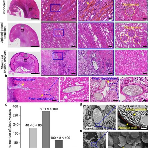 Embolization Effectiveness Of Janus Particle Engineered Structural