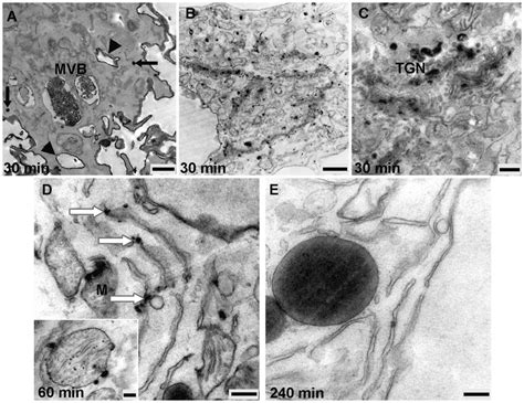 Micrographs Of Epcs Incubated With Hdl Labeld Bodipy Cholesterol