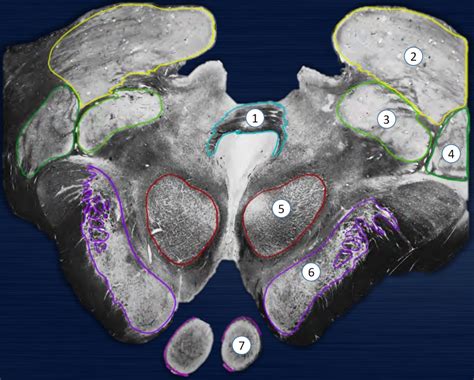 Midbrain Diencephalon Junction Fig 55 Diagram Quizlet