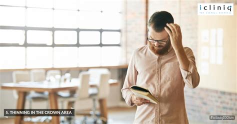 Early Signs You Re Going Bald