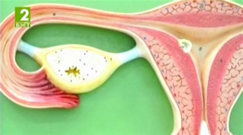 Все по слаб е интересът към ваксинирането срещу рак на маточната шийка По света и у нас БНТ