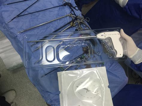 Laparoscopic Umbilical Hernia Repair 2 Dr Raad Al Saffar