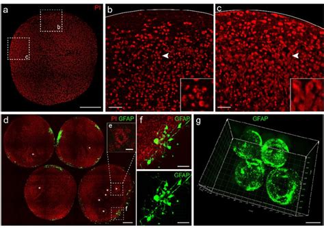 Pi Staining Results And Comparison Of Multiple Organoids A Maximum Download Scientific