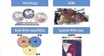 Spatial RNA Sequencing Reveals Where Atherosclerotic Plaques Rupture Can Lead To Preventive
