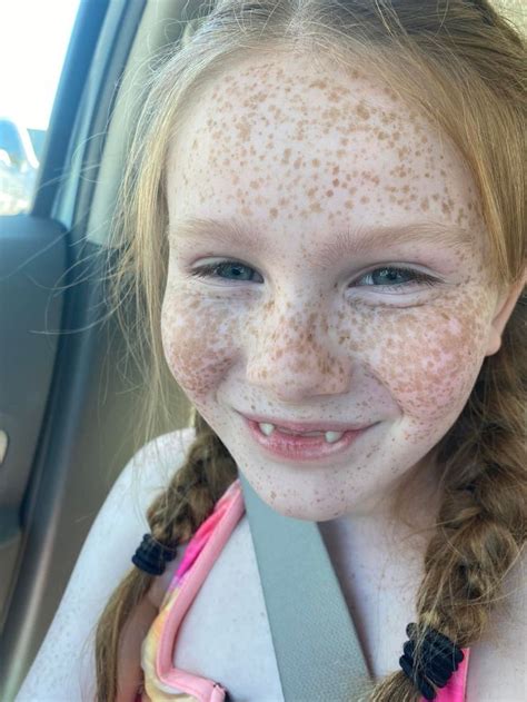 Taches De Rousseur Freckles Red Hair Redheads