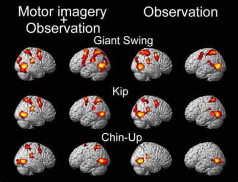 Group Activation Map Showing Activated Brain Regions During Motor Download Scientific Diagram