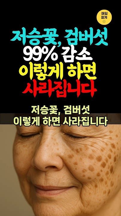 검버섯 99 줄였습니다｜저승꽃 없애는 습관 루틴 공개 검버섯없애기 피부노화 매일젊게 Youtube