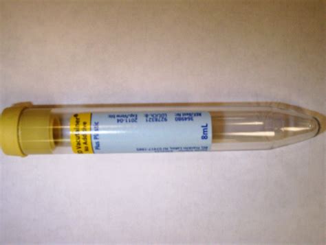 Parkview Health Laboratory Test Directory
