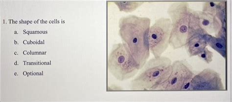 Solved 1 The Shape Of The Cells Is A Squamous B Cuboidal