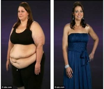 Before And After Your Shape Matters