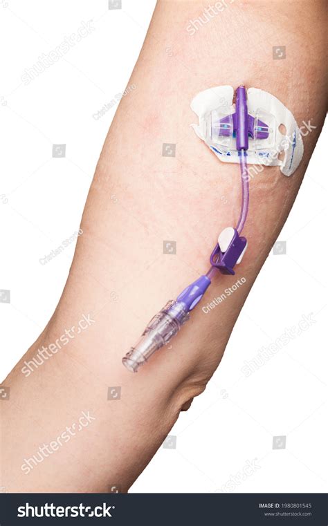 Picc Line On Arm Woman Undergoing Stock Photo 1980801545 Shutterstock