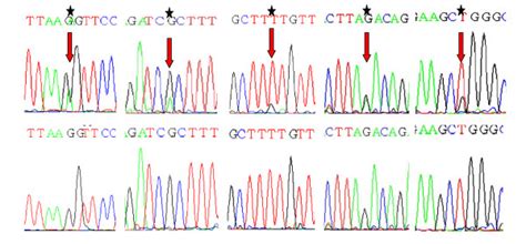 Partial Nucleotide Sequence Representing The Mutant Above And Normal Download Scientific