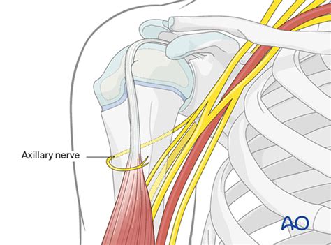 Anterolateral Approach To The Proximal Humerus