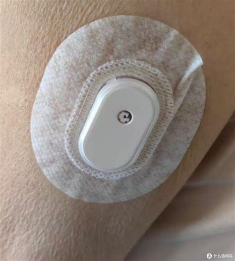如何持续、准确检测血糖？动态血糖仪真的靠谱吗？使用评测来了！血糖测量什么值得买