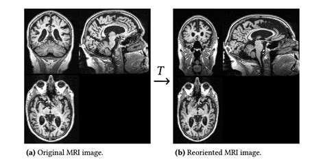 Github Alexsisaymri Retrieval Retrieval Of Brain Mri Image