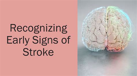 Early Warning Signs Of A Stroke