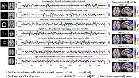A Deconvolution Algorithm For Multi Echo Functional Mri Multi Echo
