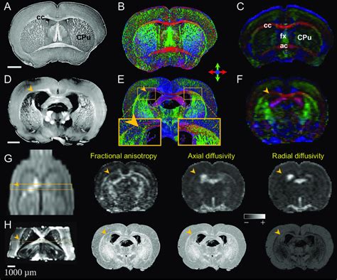 Xpct Retrieves Brain Wide Structural Connectivity In A Dti Like Manner Download Scientific